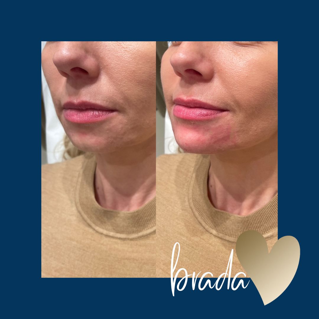 FACE EXPERT by Dr. Macko