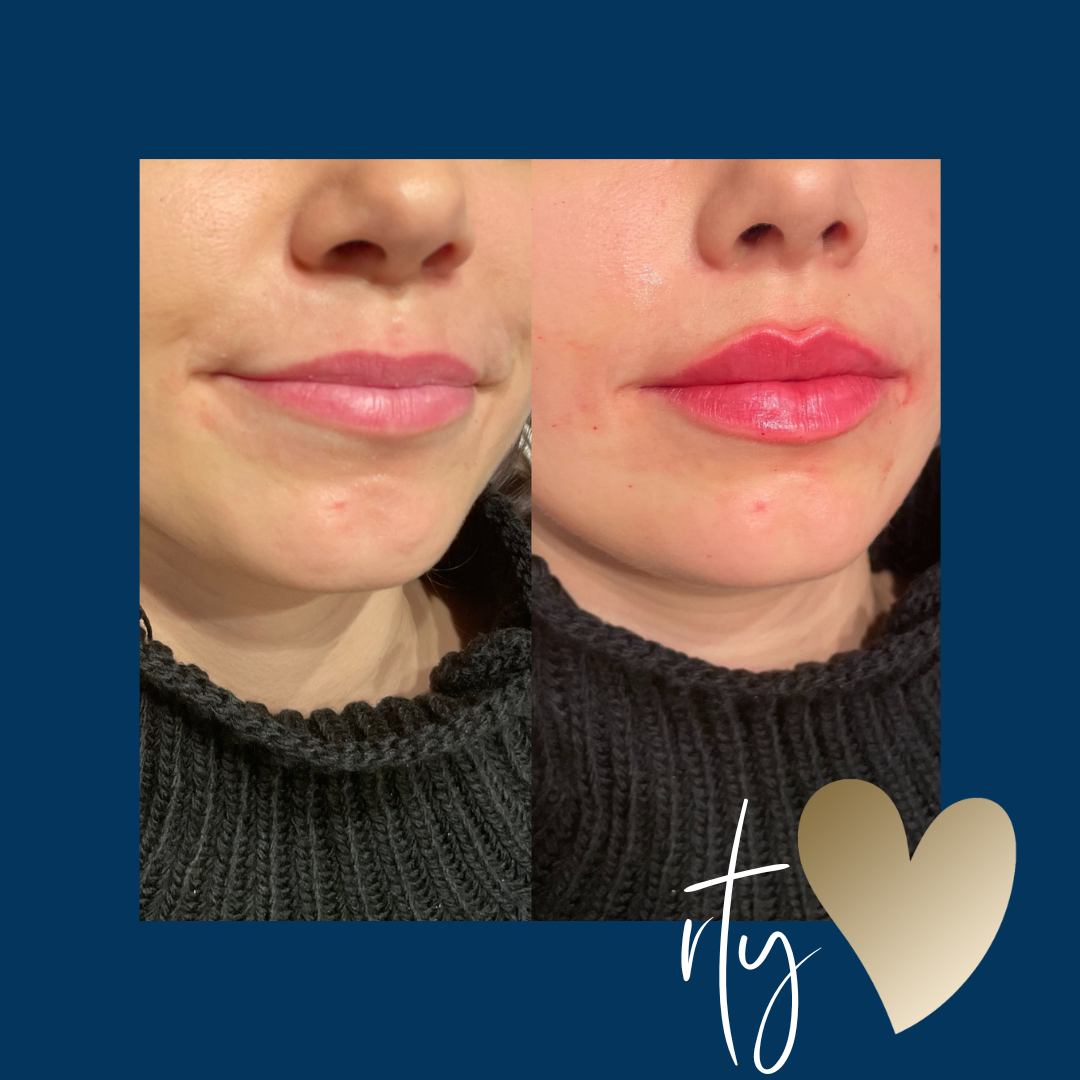 FACE EXPERT by Dr. Macko