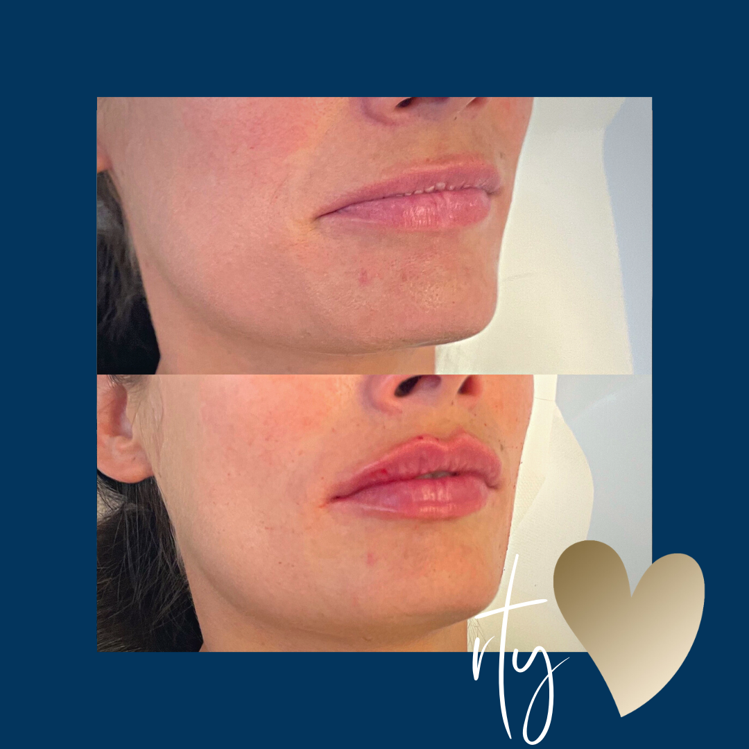 FACE EXPERT by Dr. Macko